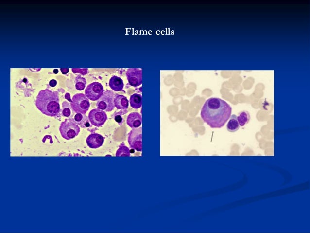 Plasma cell disorders