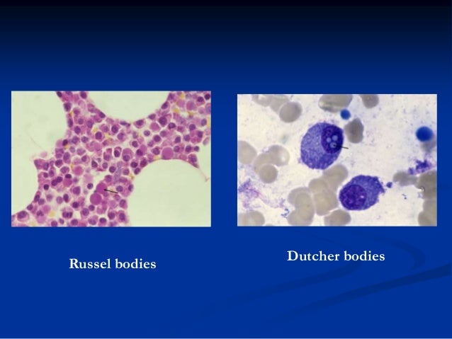 Plasma cell disorders