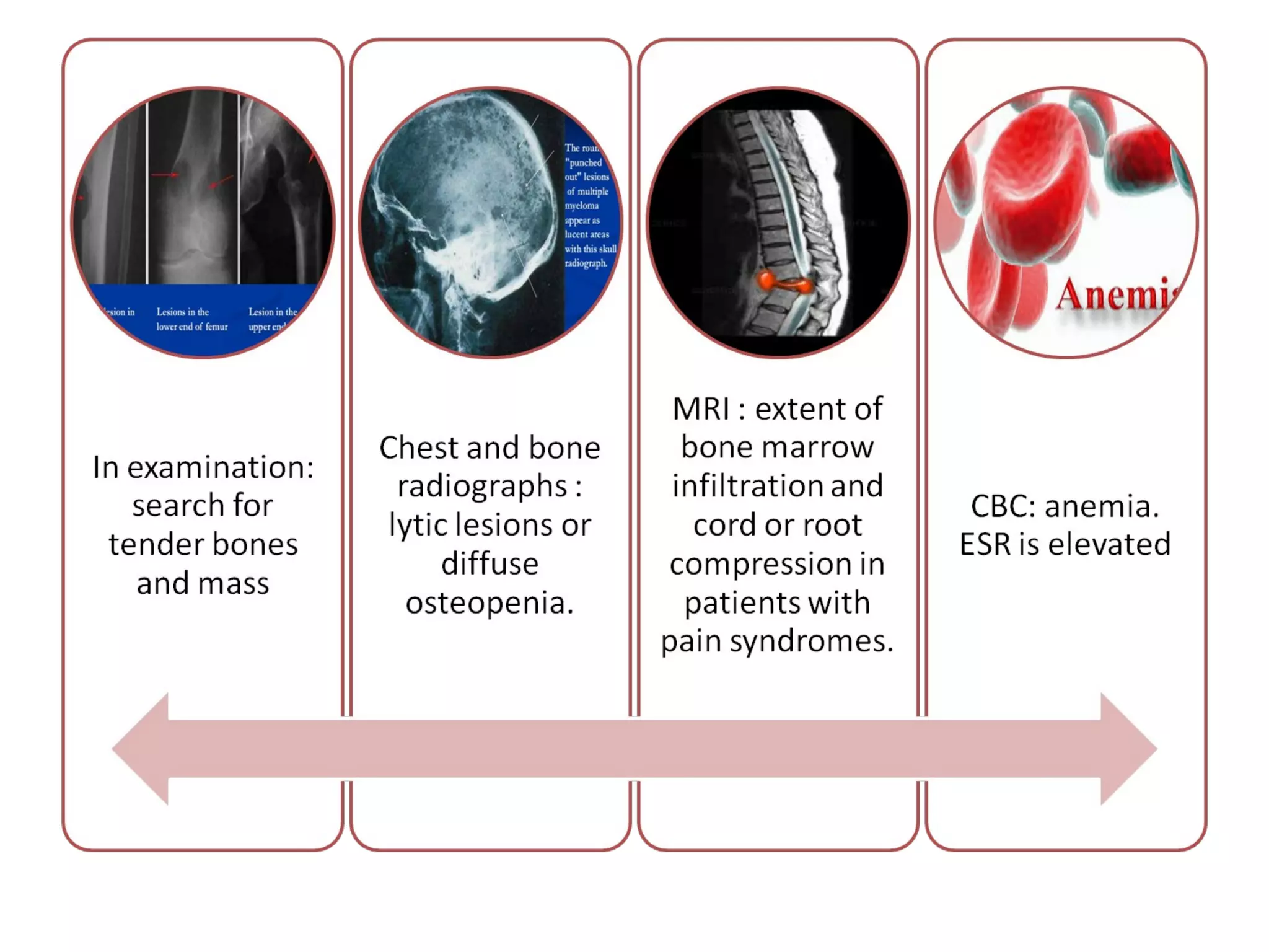 Plasma cell disorders | PPT