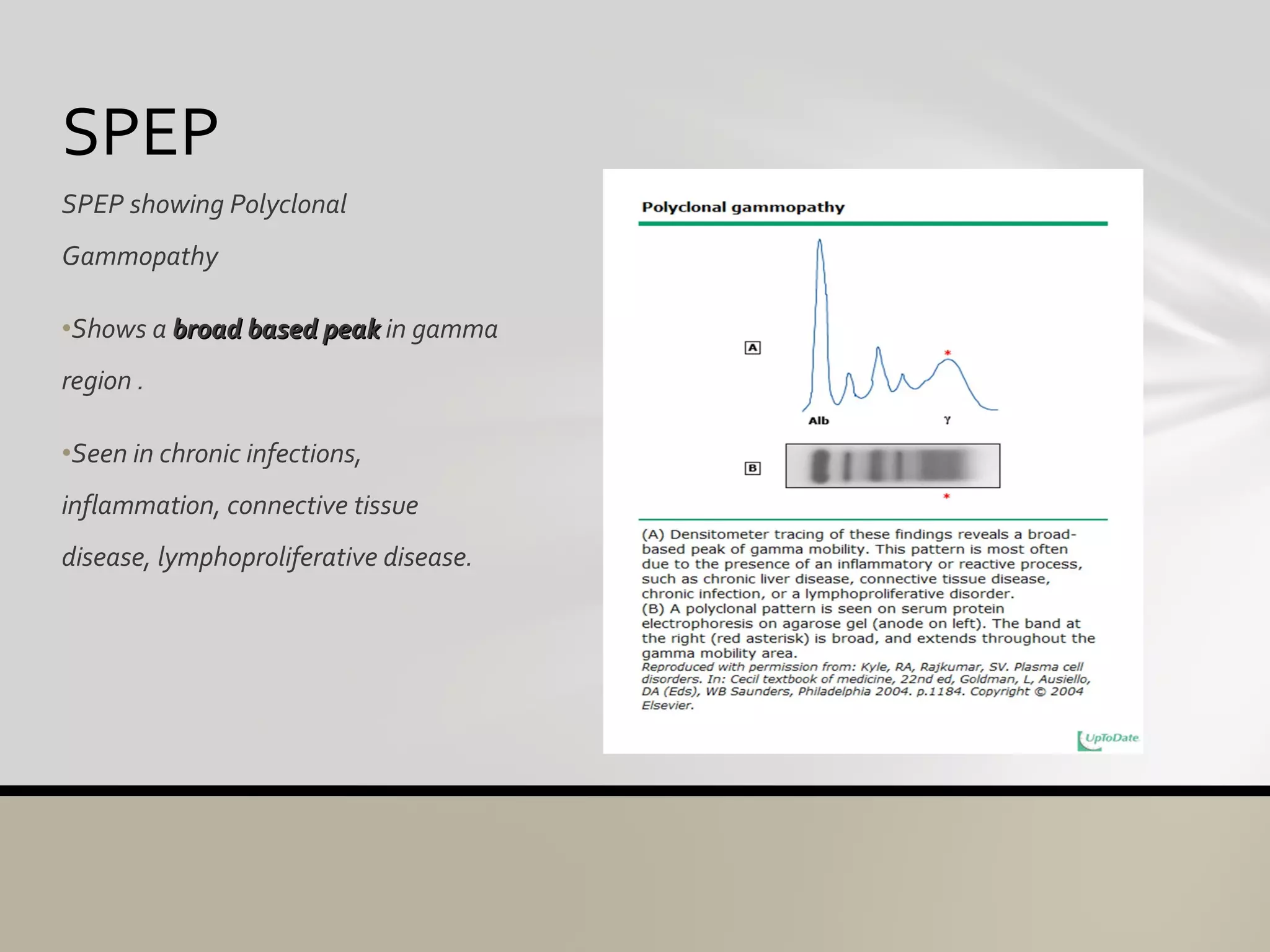 Plasma cell disorders ppt | PPT