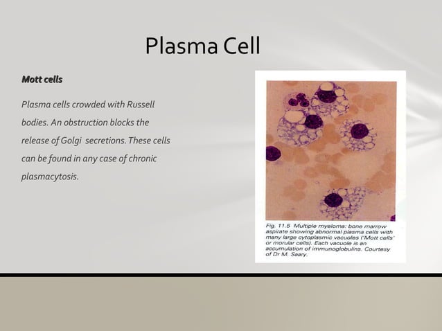 Plasma cell disorders ppt | PPT