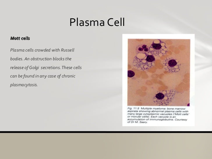 Plasma cell disorders ppt