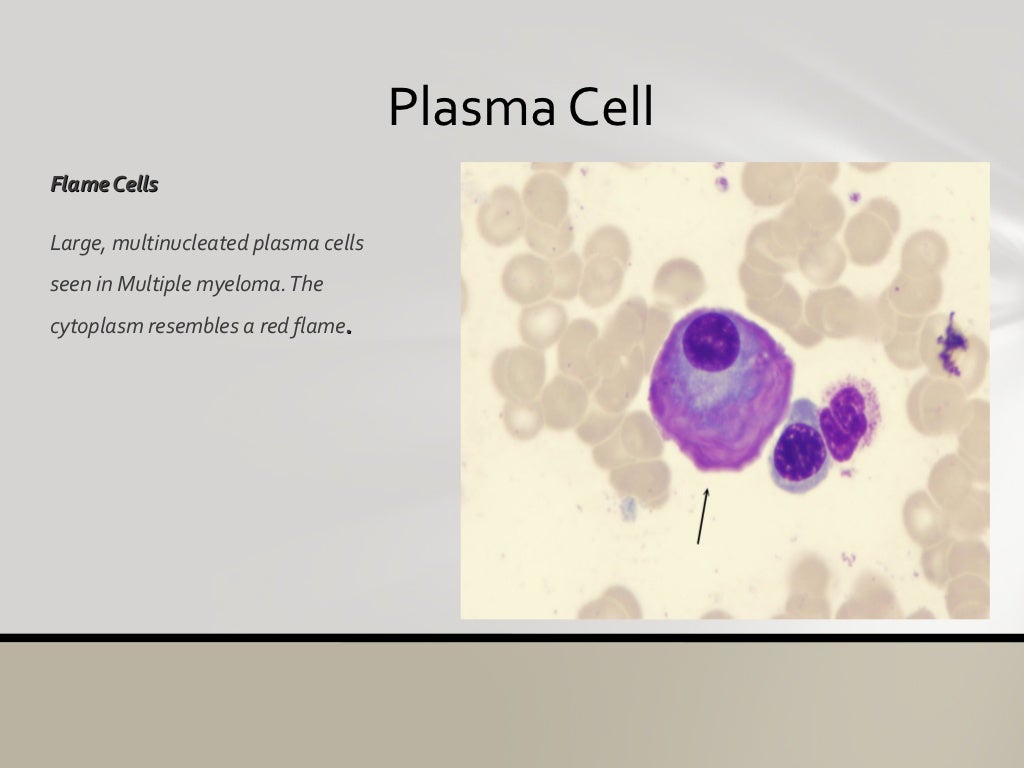 Plasma cell disorders ppt