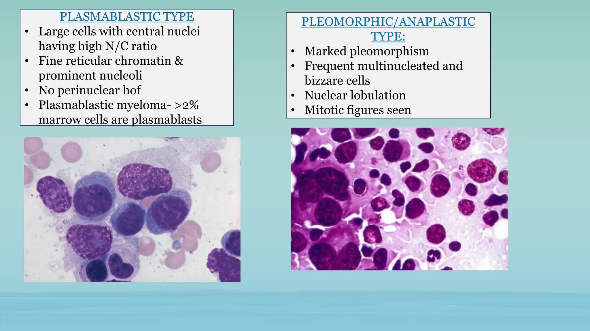 PLASMA CELL DYSCRASIAS Overview.....pptx