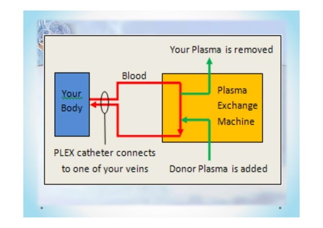 Plasma exchange in neurologic disease | PDF | Blood Disorders ...