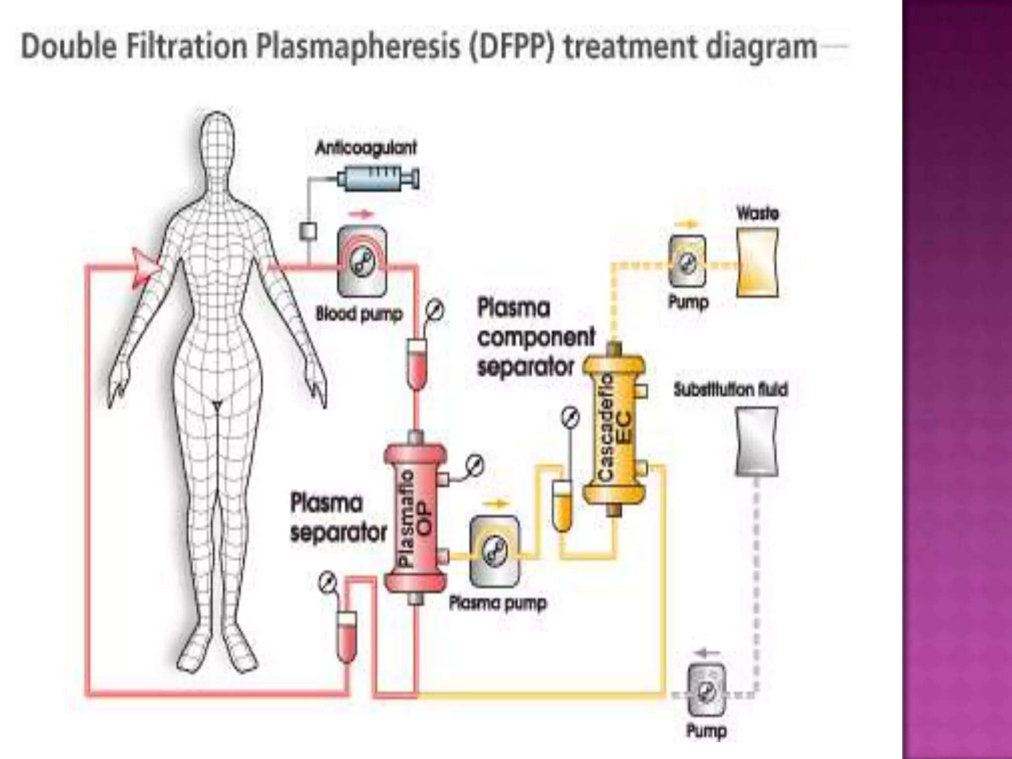 Plasmapheresis | PPTX