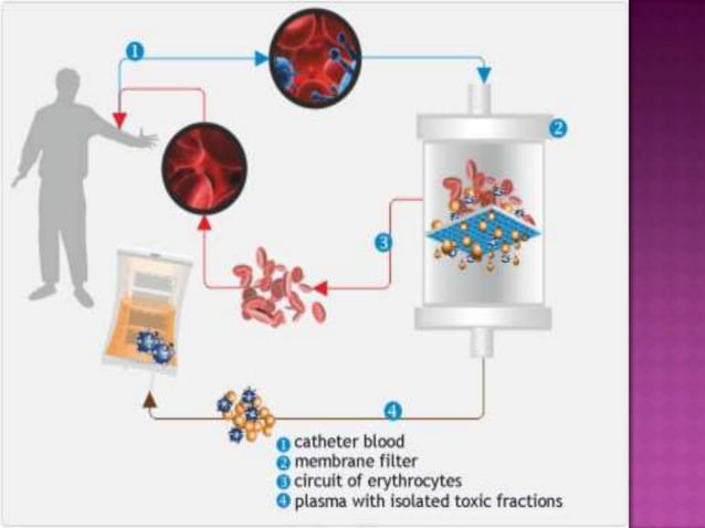 Plasmapheresis | PPTX | Blood Disorders | Diseases and Conditions