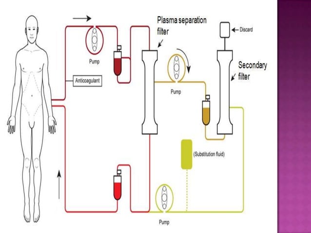 Plasmapheresis