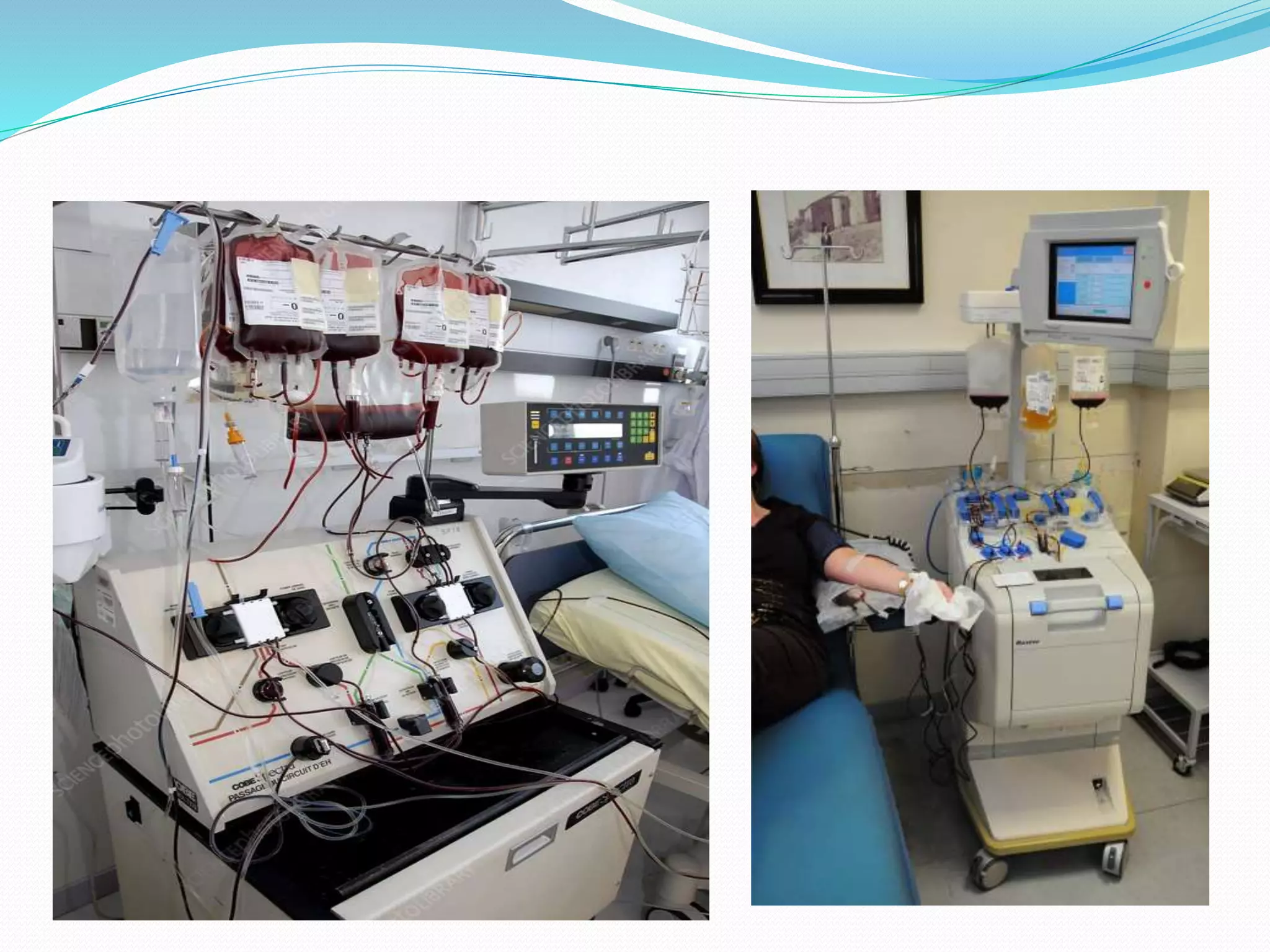 Plasmapheresis | PPTX