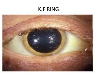 Plasma protein | PPTX