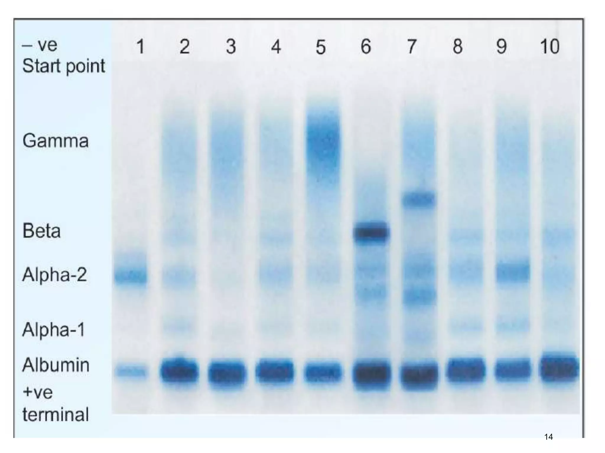 Plasma protein composition and function | PPTX