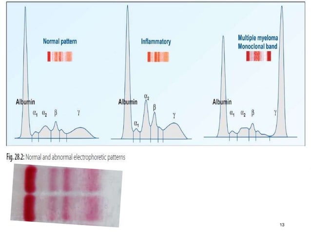 Plasma protein composition and function | PPTX | Chemistry | Science