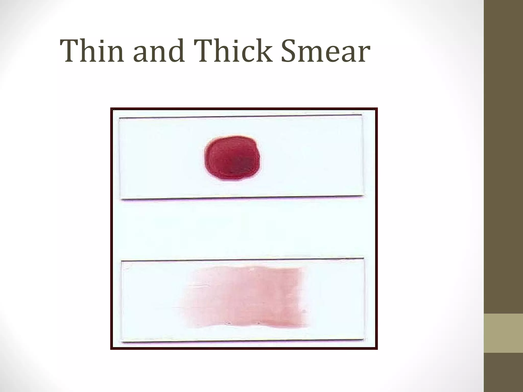Plasmodium | PPT