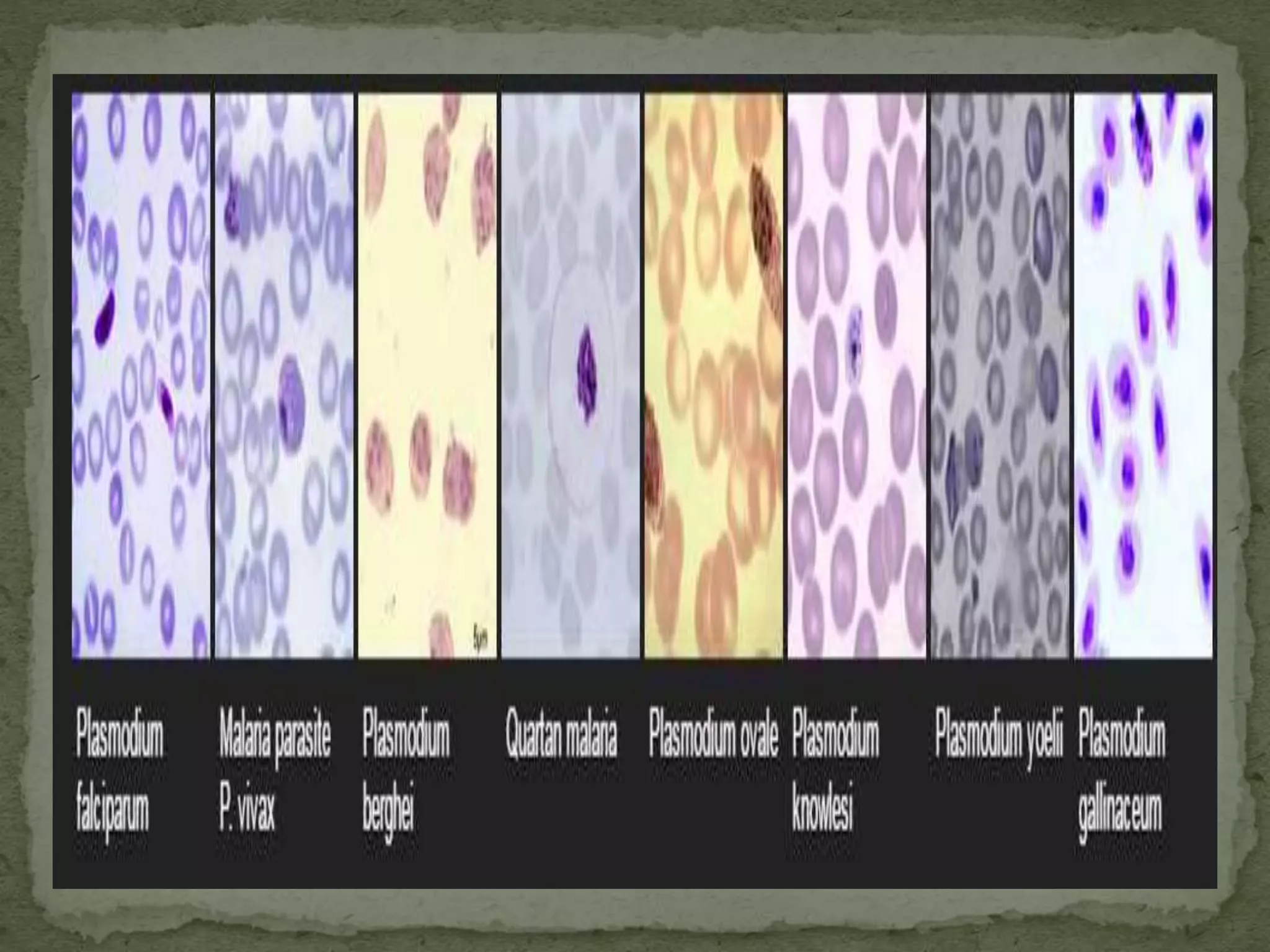 Plasmodium | PPTX | Infectious Diseases | Diseases and Conditions