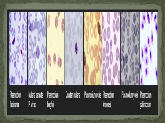 Plasmodium | PPTX | Infectious Diseases | Diseases and Conditions