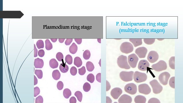 Plasmodium | PPTX | Infectious Diseases | Diseases and Conditions