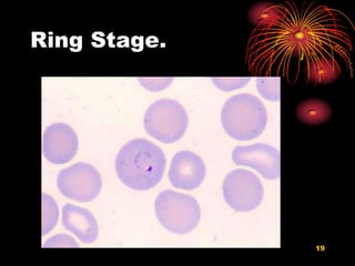 Plasmodium malarial parasite | PPSX