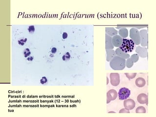 plasmodium falciparum adalah salah satiu dari beberapa jenis malaria | PPT