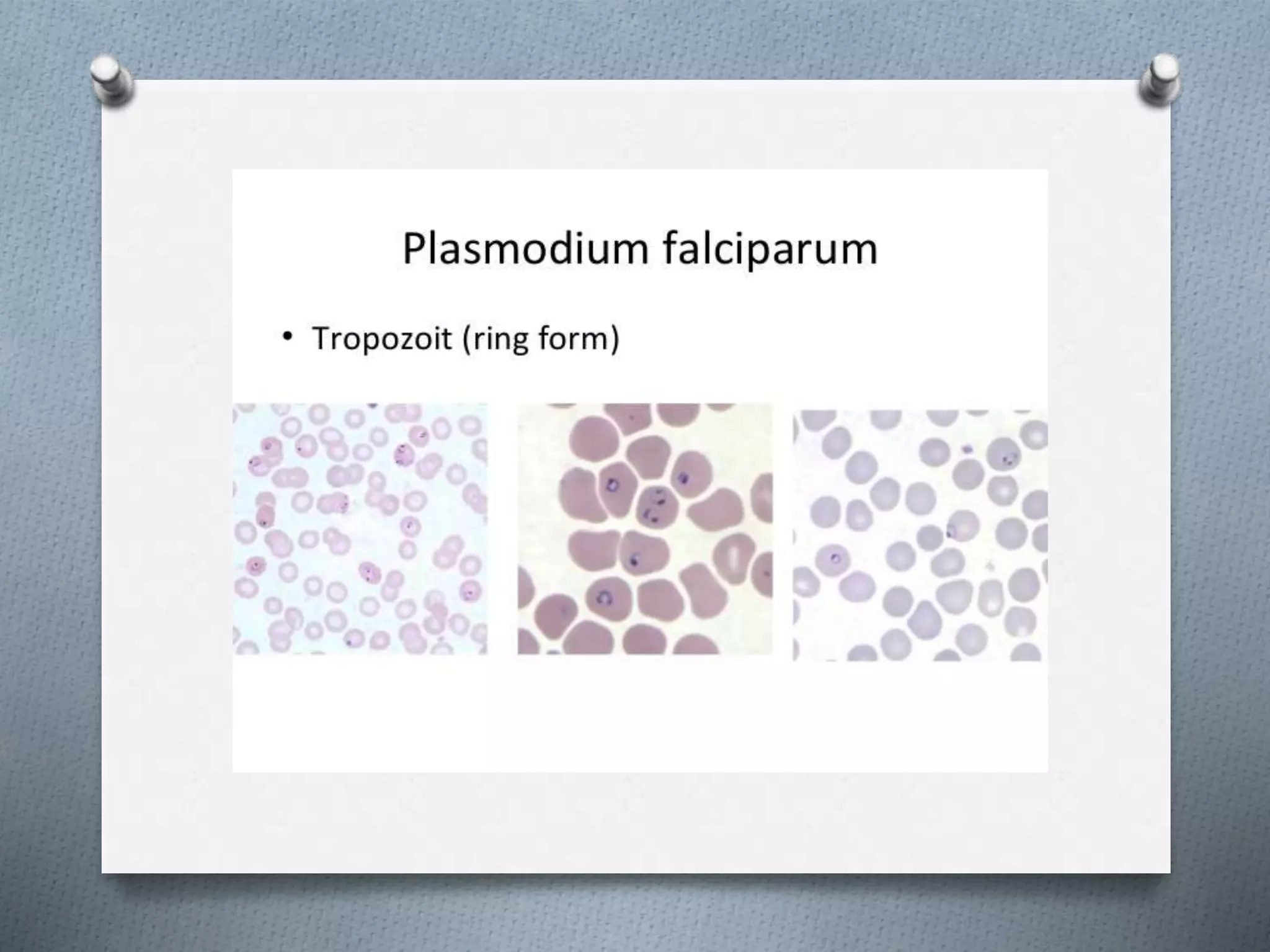 Plasmodium falciparum ppt | PPTX