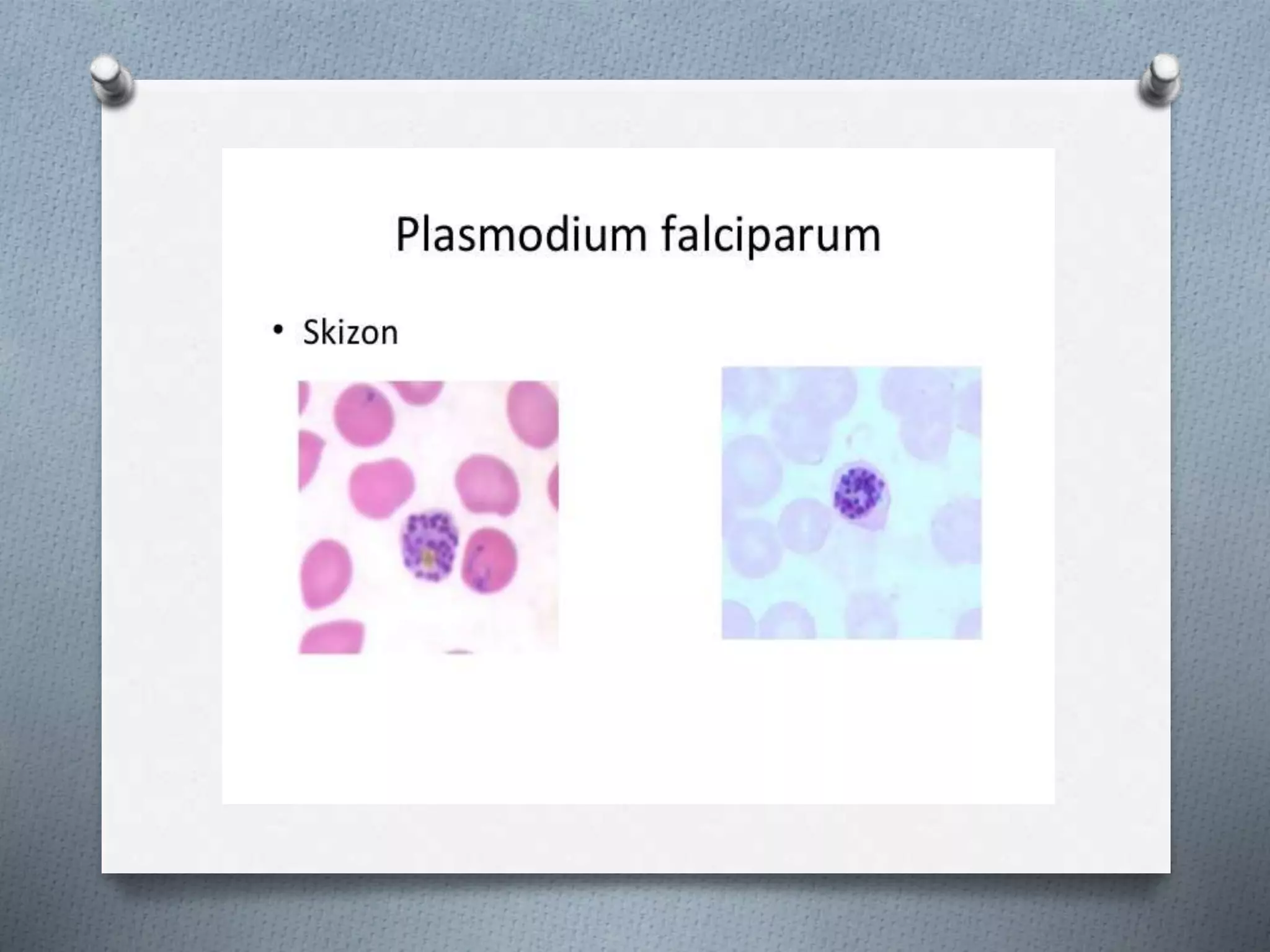 Plasmodium falciparum ppt | PPTX