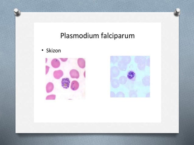 Plasmodium falciparum ppt | PPTX