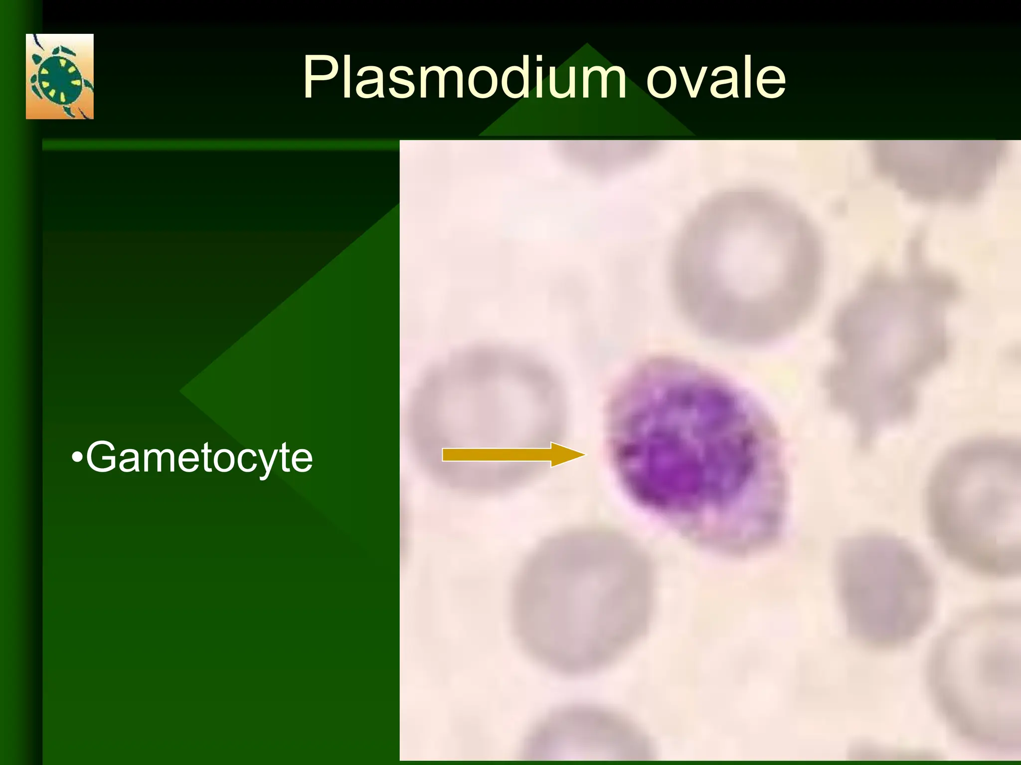 Plasmodbbbbbbbbbbbbbbbbbbbbium ovale.pptx