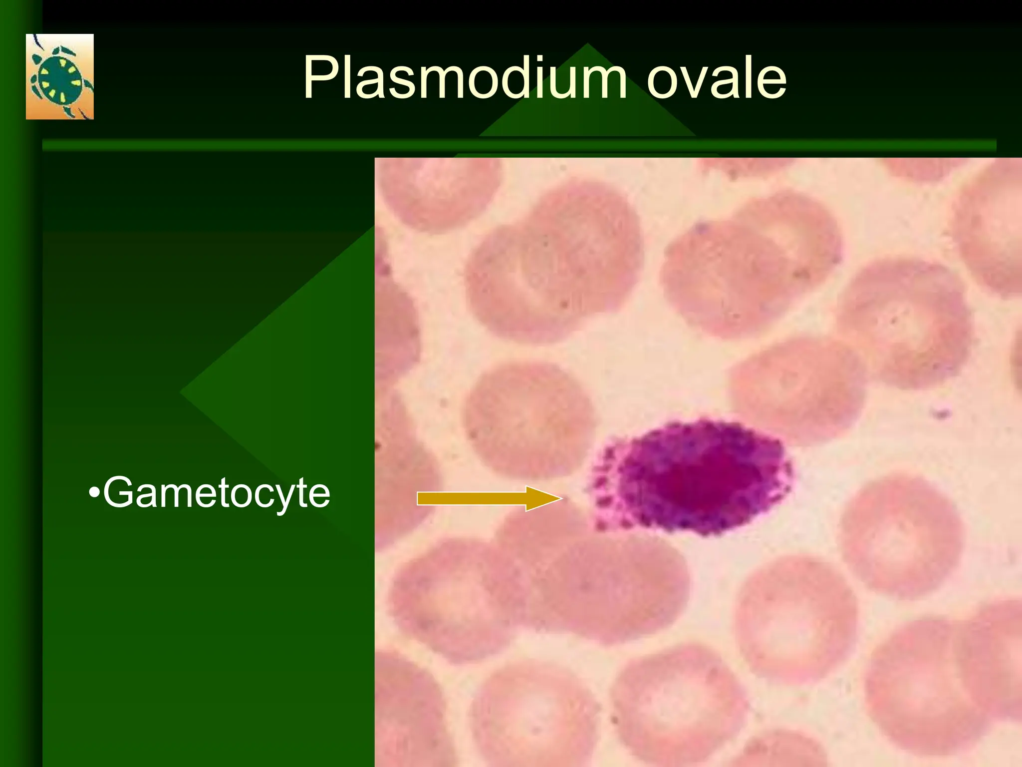 Plasmodbbbbbbbbbbbbbbbbbbbbium ovale.pptx