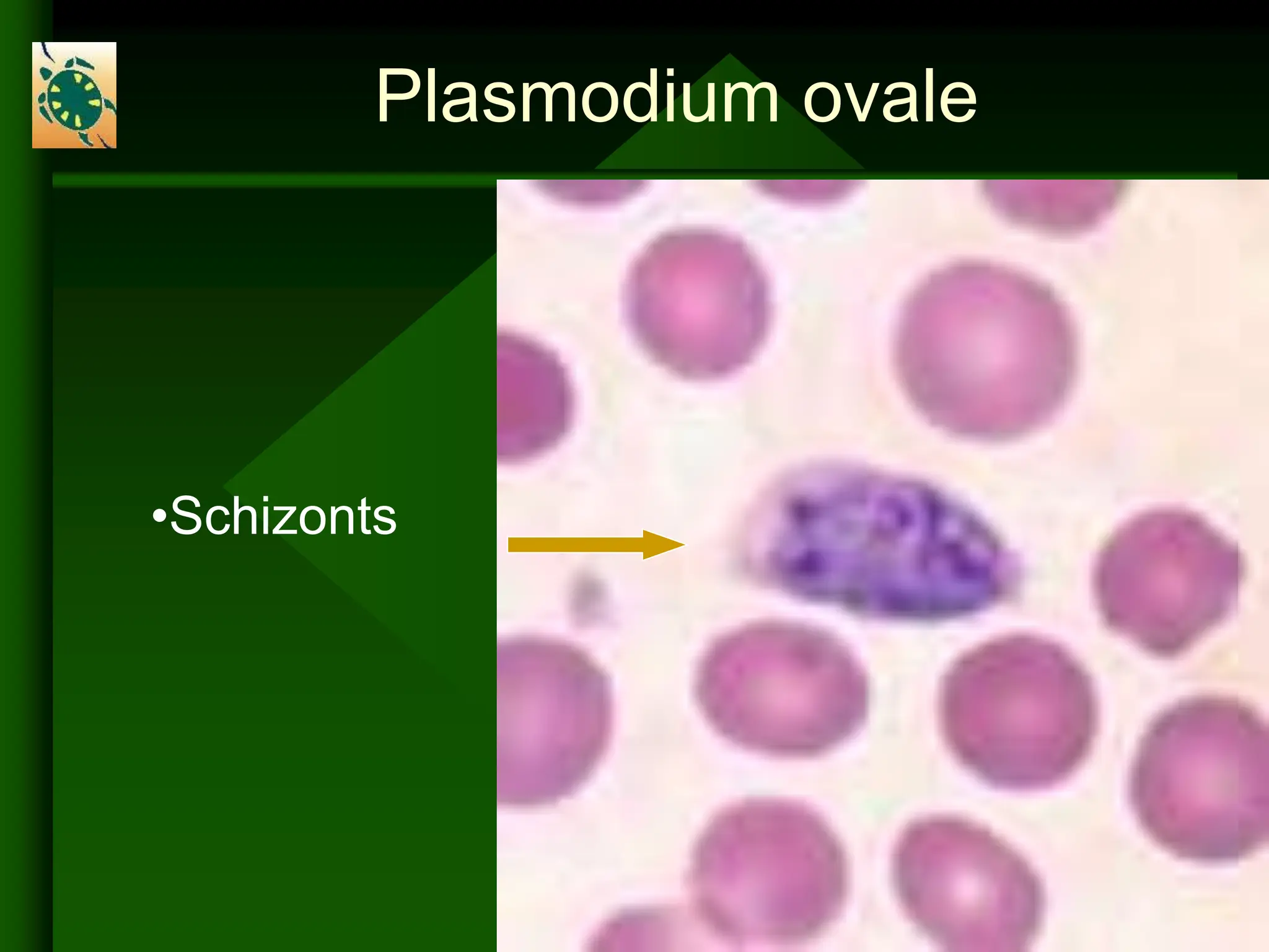 Plasmodbbbbbbbbbbbbbbbbbbbbium ovale.pptx