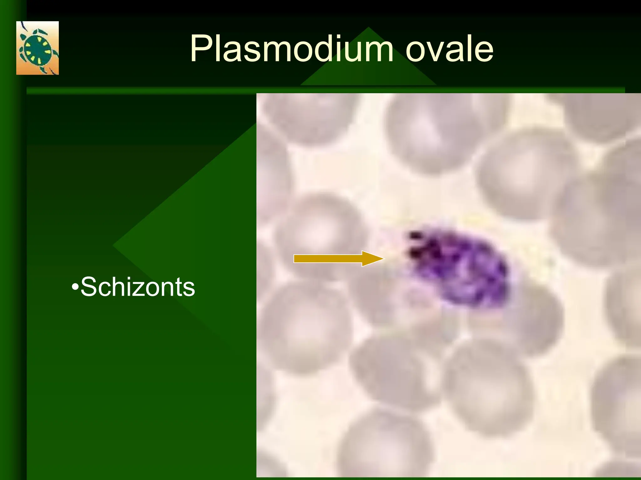 Plasmodbbbbbbbbbbbbbbbbbbbbium ovale.pptx