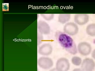 Plasmodbbbbbbbbbbbbbbbbbbbbium ovale.pptx