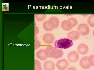 Plasmodbbbbbbbbbbbbbbbbbbbbium ovale.pptx
