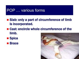 Plaster of Paris and Plaster Technique | PPTX