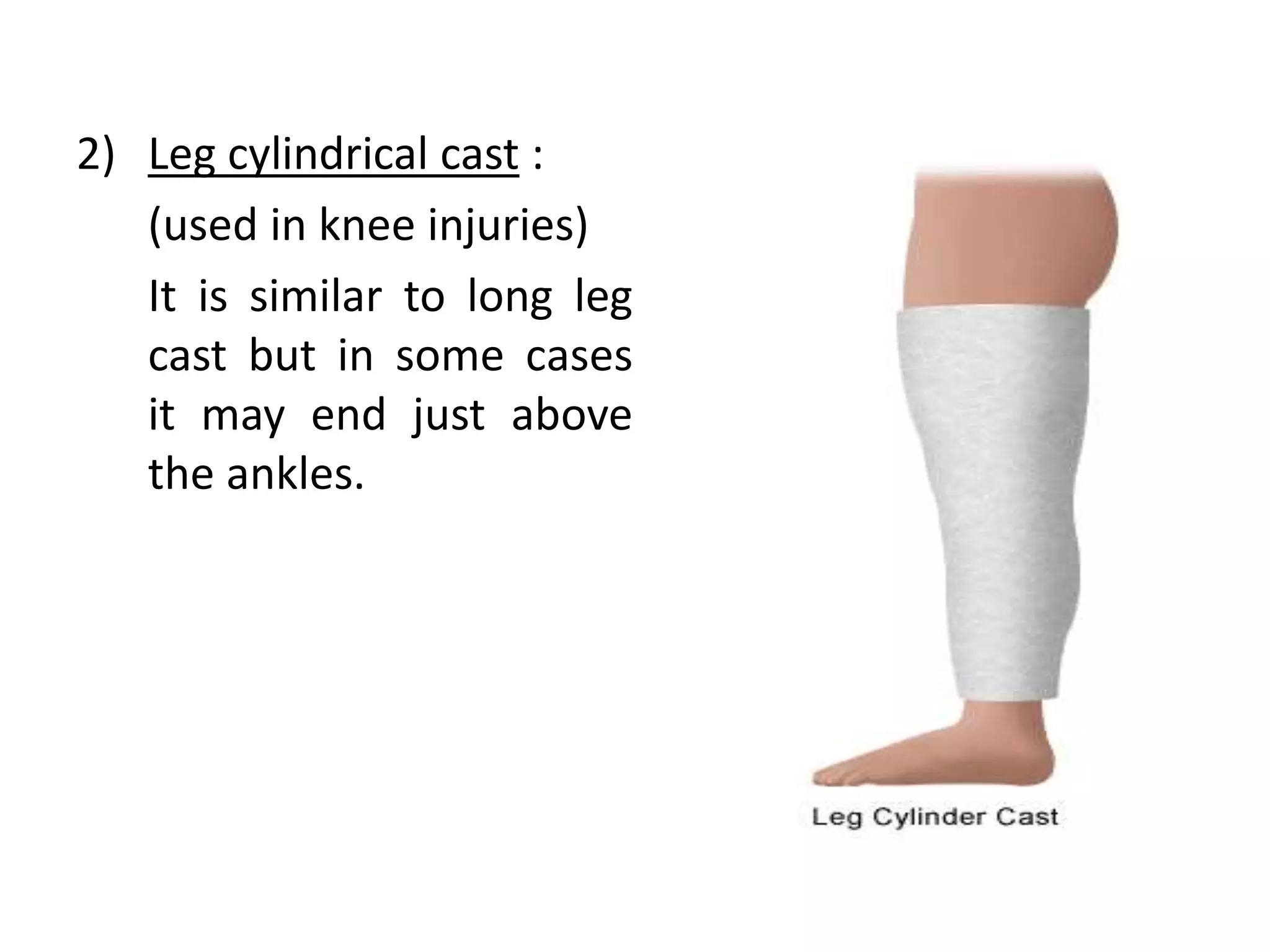 Plaster cast and its type | PPTX