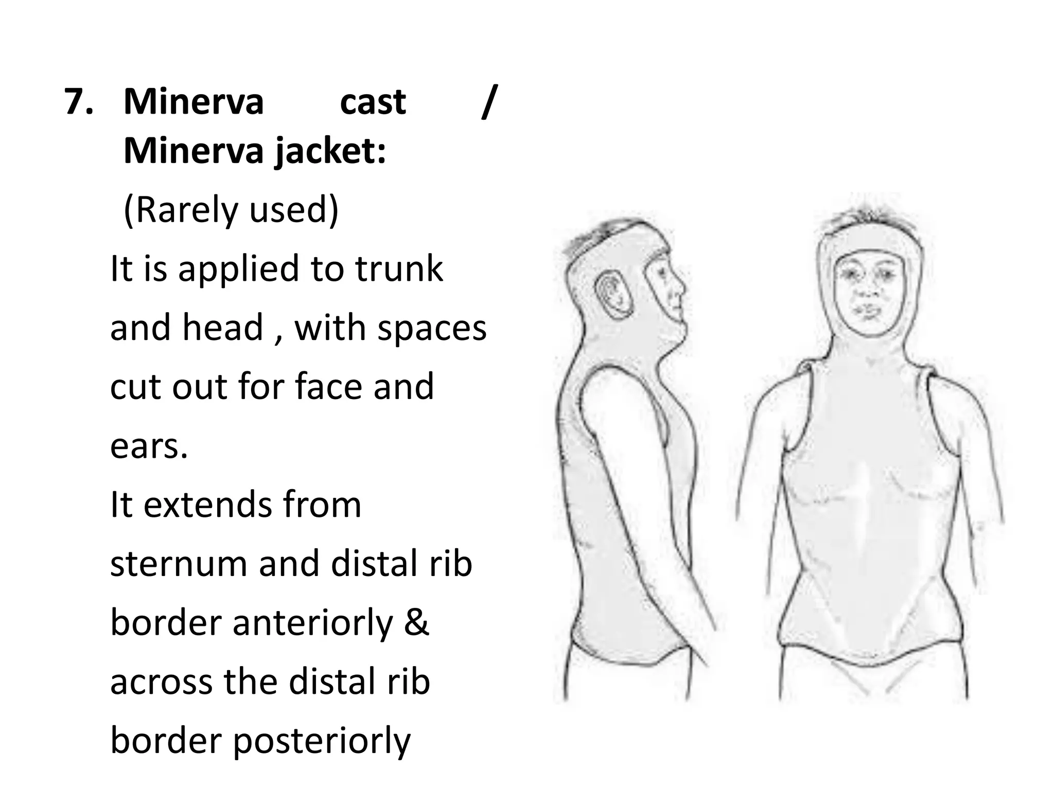 Plaster cast and its type | PPTX
