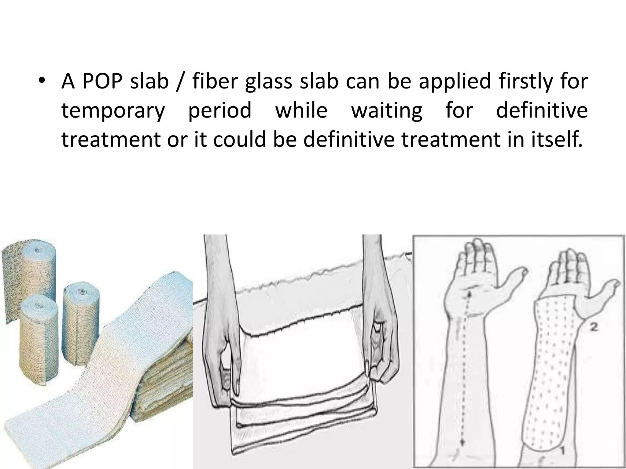 Plaster cast and its type | PPTX
