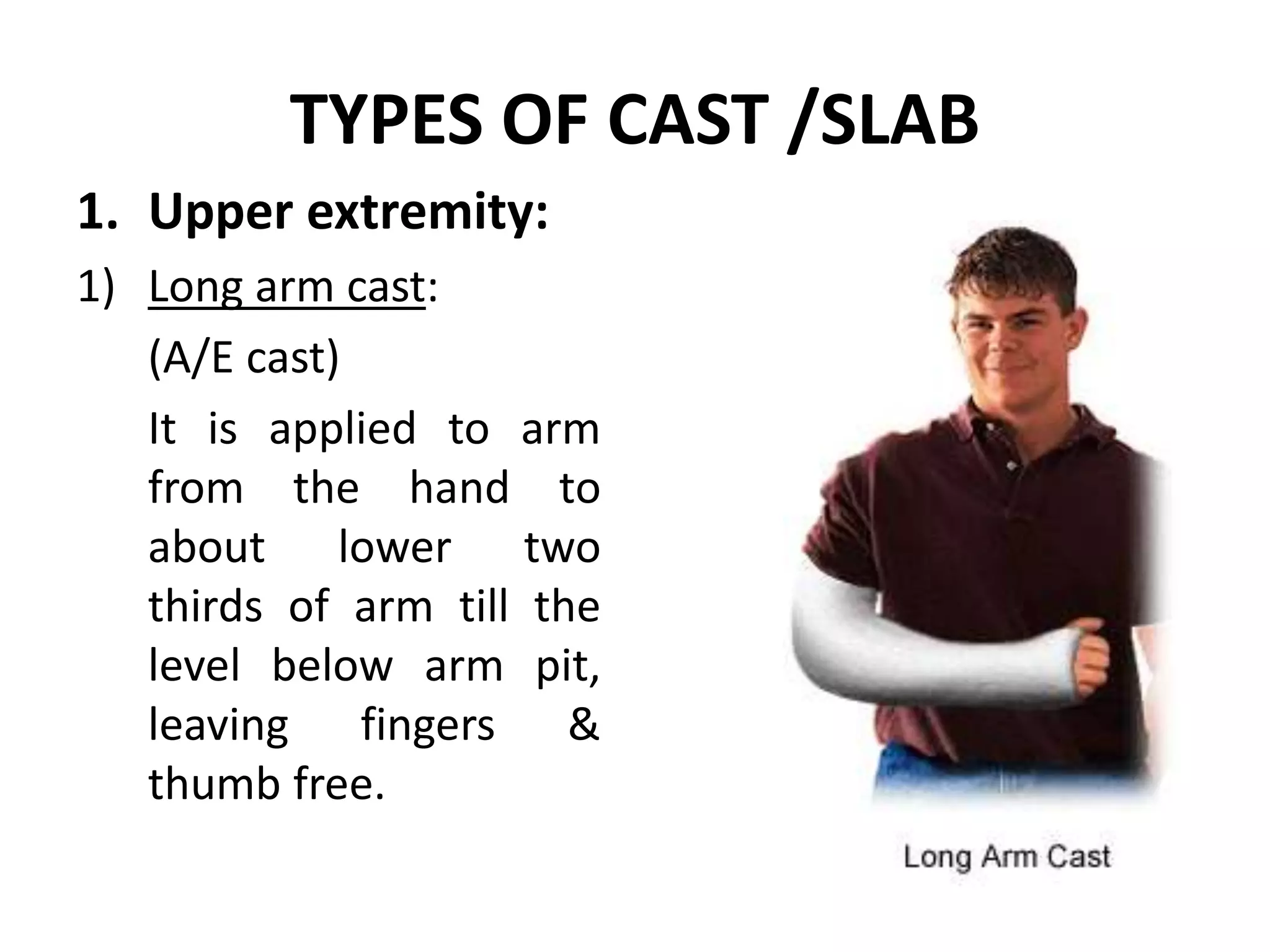 Plaster cast and its type | PPTX