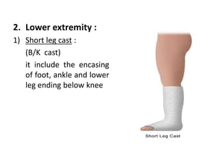 Plaster cast and its type | PPTX