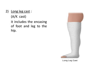 Plaster cast and its type | PPTX