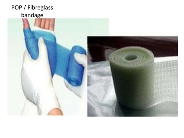 Plaster cast and its type | PPTX