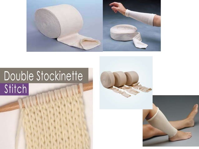 Plaster cast and its type | PPTX