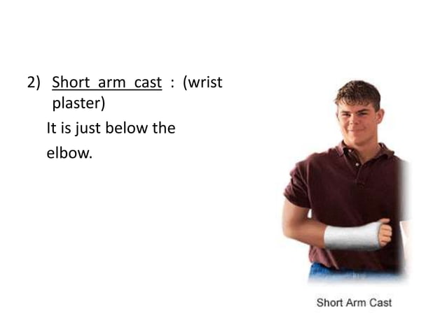 Plaster cast and its type | PPTX