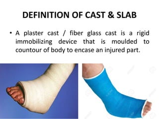 Plaster cast and its type | PPT