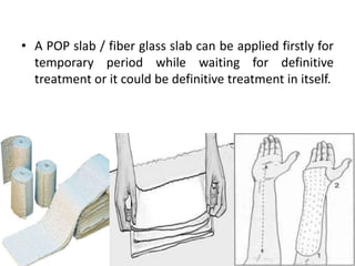 Plaster cast and its type | PPT