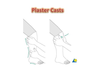 Plaster casts | PPTX