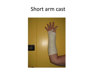 Plaster casts | PPTX