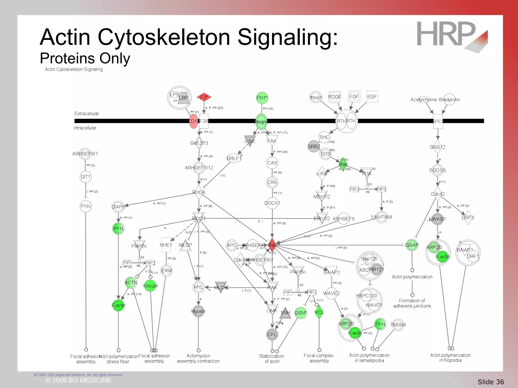 Mechanisms of Plaque Rupture in Advanced Atherosclerosis | PPT