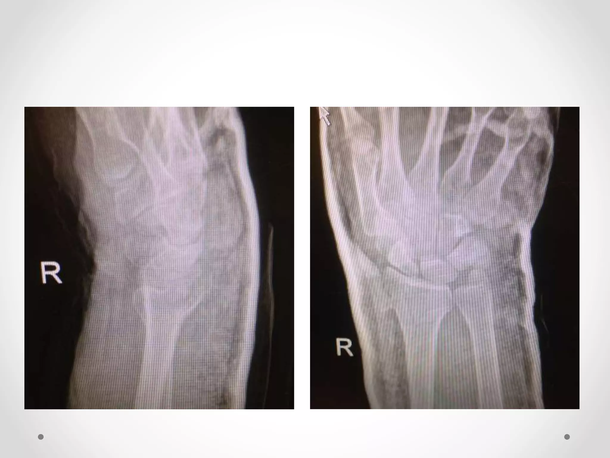 Plaster Tips and Tricks | PPTX