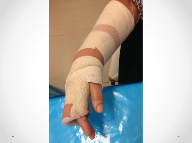 Plaster Tips and Tricks | PPTX