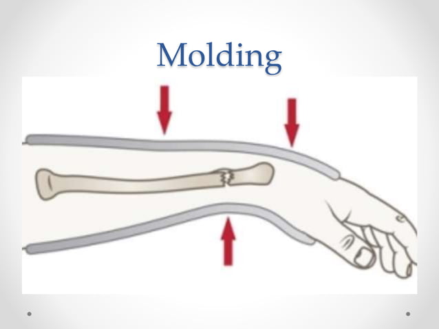 Plaster Tips and Tricks | PPTX