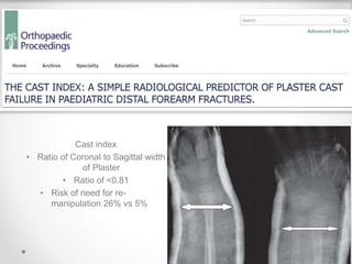 Plaster Tips and Tricks | PPTX